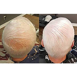 Zenagen Revolve Thickening Hair Loss Treatment for Men, 6.75 Fl Oz