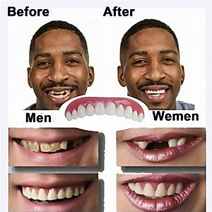 XuRX Veneers Teeth Natural Tone ​Temporary Dentures Teeth Top and Bottom Instant Teeth Men and Women Veneers Snap on Comfort Smile Silica Gel Dentures for Bad Teeth, 5 Pairs