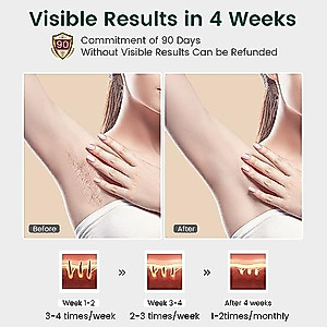 JOVS Venus Pro Ⅱ IPL Hair Removal for Woman & Man 330° Rotation Head Sapphire Cooling Unlimited Flashes Hair Removal Device at Home Use Safe for Whole Body Painless, FDA Cleared - Emerald