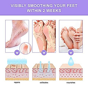 YING HUA XING Foot Mask, Dry Feet Skin Remover Mask, Foot Skin Peeling Mask Large, Foot Masks For Dry Cracked Feet- Lavender 3 Pack