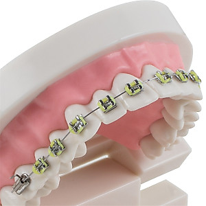 Dental Adult Typodont Demonstration Teeth Model Orthodontic Model Teeth Teach Study Model with Brackets