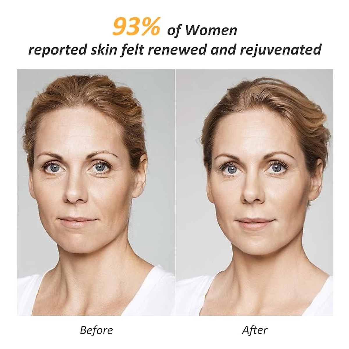 WarmDerm Skin Firming Facial Device, Professional Home Beauty Device for Face and Body, 3 Energy Levels - Salon Results