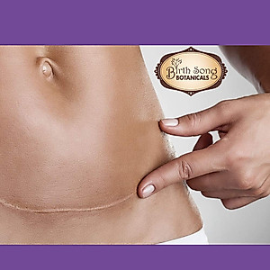 Birth Song Botanicals Umbilical Cord Care Powder, Herbal Support for Postpartum, Baby Shower Gift, Pregnancy, All Natural, Plant Based, Woman, Birth, 0.2oz