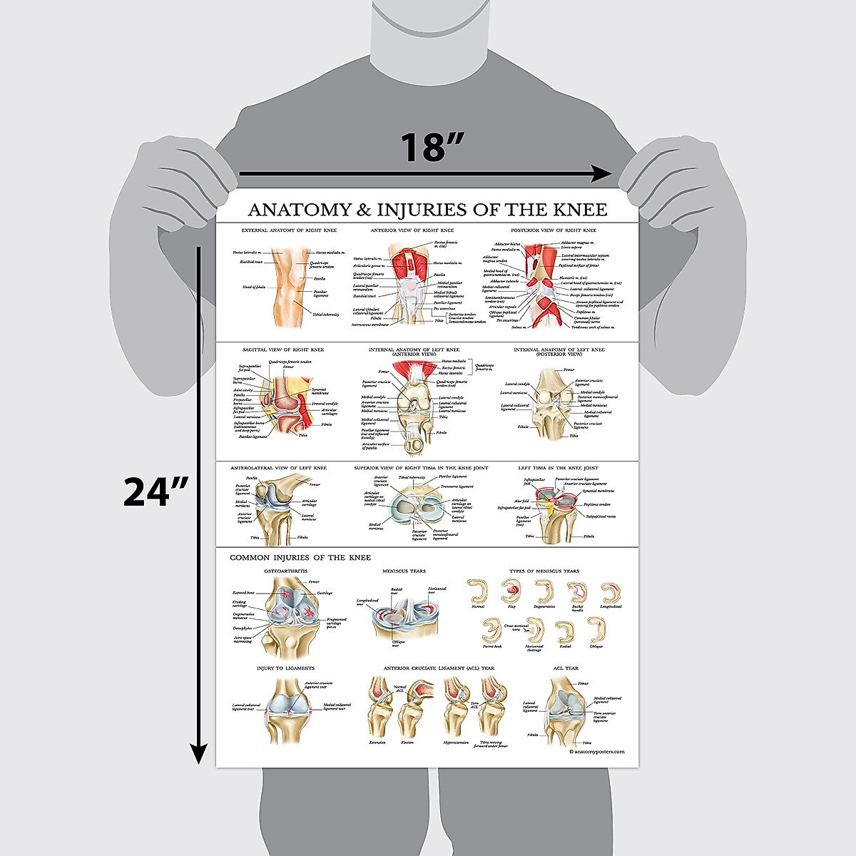 Palace Learning Laminated Anatomy and Injuries of the Knee Poster - Knee Joint Anatomical Chart - 18" x 24"