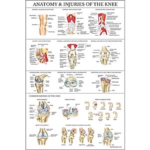 Palace Learning Laminated Anatomy and Injuries of the Knee Poster - Knee Joint Anatomical Chart - 18" x 24"