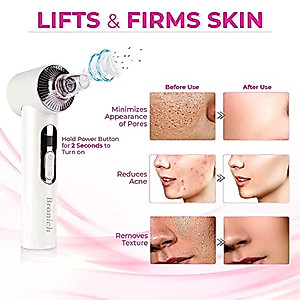 Bronich FDA Certified-Newest Blackhead Remover Pore Vacuum with 30X HD Camera,Deep Pore Cleaner and Blackhead Extractor with 5 Adjustable Suction Levels,USB Rechargeable for Women-Men Skin Care