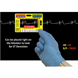 R-CAT EKG Badge