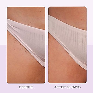 First Aid Beauty Ingrown Hair Pads with BHA + AHA – Ingrown Treatment Pads Exfoliate to Help Prevent Razor Bumps – For Underarm + Bikini Area – Compostable for Daily Use – 60 pads