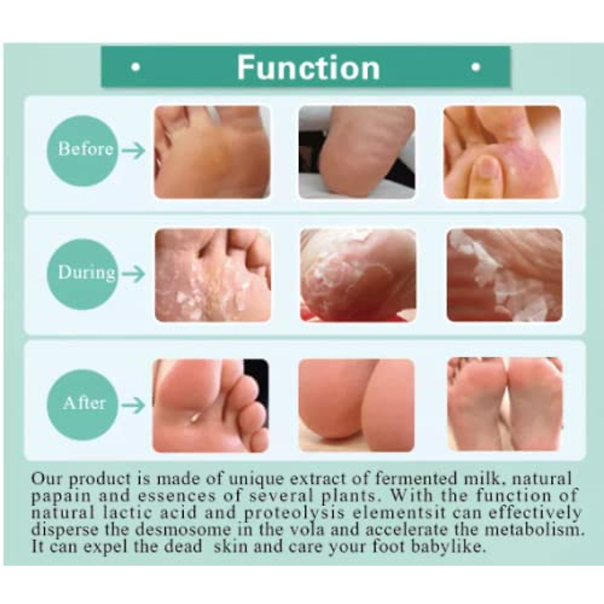Peach Foot Peel Mask - Repair Cracked Heels, Remove Dead Skin. Makes Your Feet soft And Beautiful