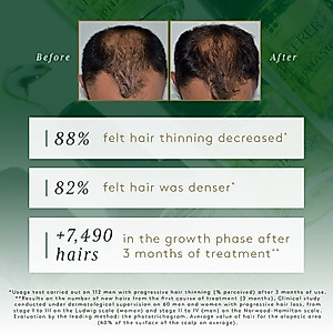 René Furterer TRIPHASIC Progressive Concentrated Serum - Hereditary & Hormonal Thinning Hair - Receding Hairline - Drug-Free - 8 ct., 30-Day Supply