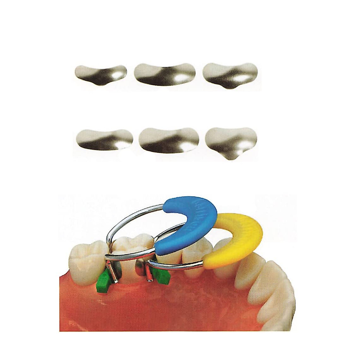 50Pcs Dental 50μm Sectional Contoured Metal Matrices Matrix Refill (Large with Ledge)