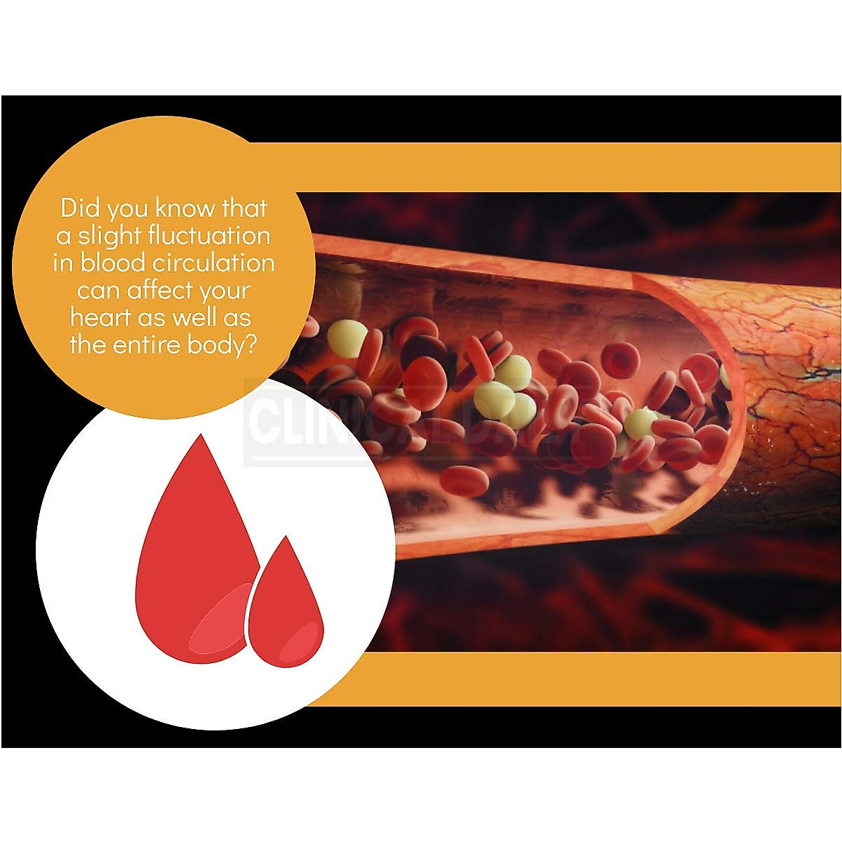 Clinical Daily Blood Circulation Supplements. Butchers Broom, Horse Chestnut, Hawthorn, Cayenne, Arginine, Diosmin Varicose Veins Treatment for Legs. Poor Circulation and Vein Support. 90 Capsules.