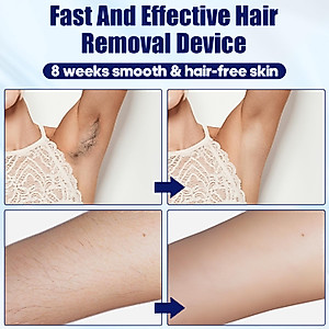 Portable Facial Hair Removal Device for Women & Men,TUMAKOU ICE Cool Hair Removal System Upgrade Ice Compress, 500,000 Times Hair Remover Machine for Face and Body Function