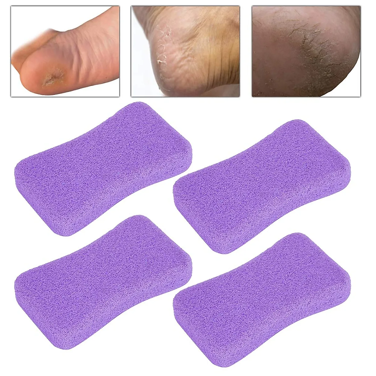 Pumice Stone for Feet, 4pcs Callus Remover and Foot Scrubber Pedicure Exfoliator Tool Hard Skin Callus Remover and Scrubber Portable Foot File Exfoliation to Remove Dead Skin()