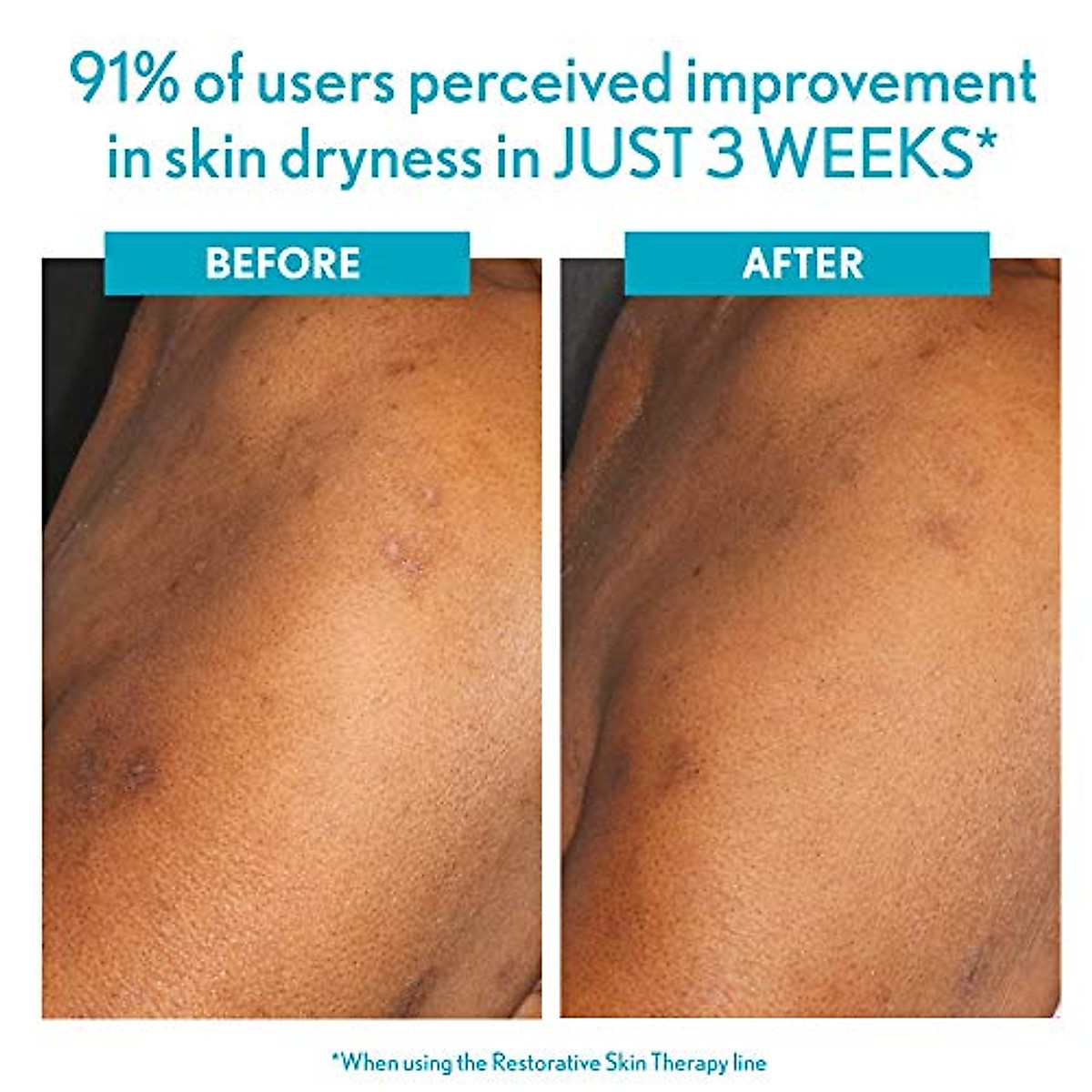 Aveeno Restorative Skin Therapy Moisturizing Oat Repairing Cream for Sensitive, Distressed, Dry Skin, with Prebiotic Oat & Aloe, Formulated without Parabens, Fragrance & Steroids, 12 oz