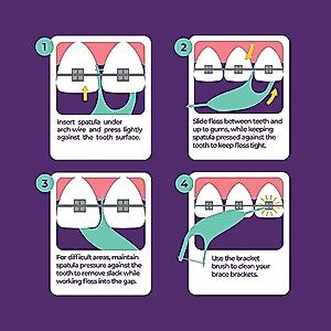 Platypus Orthodontic Flossers for Braces, 30 Count (Pack of 3), Ortho Picks for Adults & Kids, Fits Under Arch Wire, Non-Damaging, Encourage Flossing Habits
