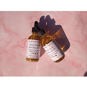 All-Natural Red Onion & Garlic Ayurvedic Hair Growth Oil Reduce Hair Shedding, Great Hair & Scalp Moisturizer, Herbal Hair Growth Oil For Frizzy, Dry, Curly, Damaged Hair- Safe for Dreadlocs, Color Treated Hair, Mens, Womens & Children's Hair