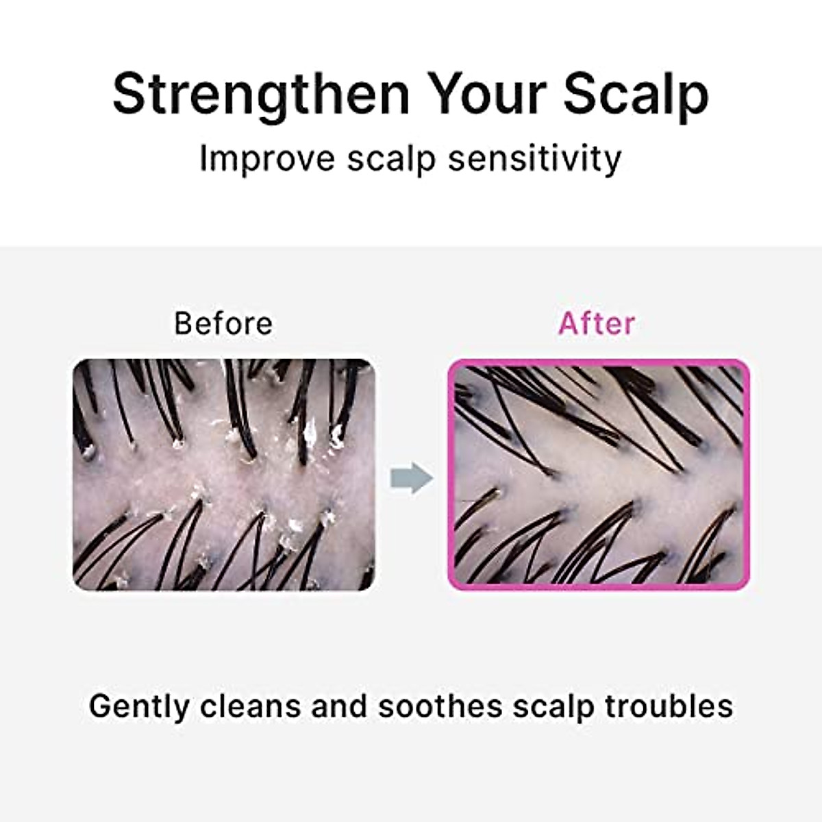 simplyO Refreshing Scalp Shampoo | Biotin & Panthenol I Dry, Itchy Scalp | Paraben-Free, Sulfate-Free I Green Breeze I 10.1 fl. oz