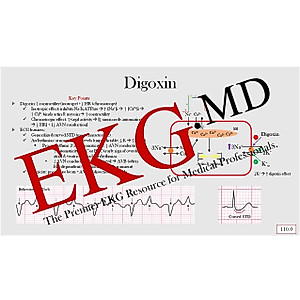 Ultimate EKG Breakdown - The EKG Guy
