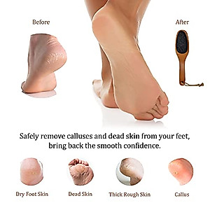 Pumice Stone for Feet & Foot Brush with Handle 2-in-1 Pedicure Scrubber for Shower - Double-Sided Pumice Foot File with Brush for Callus, Cracked Heels, Dead, and Dry Skin Removal