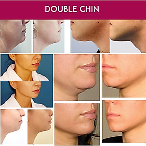 Neck, Chin & Jawline Sculpting V Line Chin Facial Mask and - Face Sagging Skin Garment Strap Bandage. Anacis