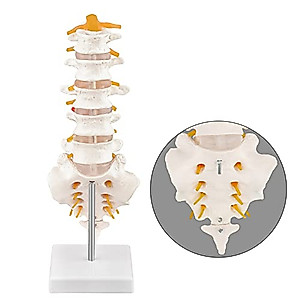 Ultrassist Human Spine Model with 5 Lumbar Vertebrae, Herniation Discs, Lumbar Nerves and Spinal Cord for Medical Teaching