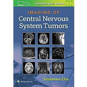 Imaging of Central Nervous System Tumors