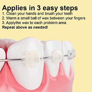 Braces Wax - 10 Pack for Dental Aligners, Unscented & Flavorless - Includes Reusable Travel Case - Food Grade