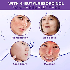 Farmirosa Dark Spot Remover Serum for Face and Body, 50ml, with Kojic Acid, Hyaluronic Acid, and 4-Butylresorcinol