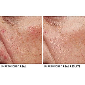 it COSMETICS Bye Bye Redness - Sensitive Skin Moisturizer - Reduces Facial Redness - With Colloidal Oatmeal, Aloe & Cucumber - 2.0 oz