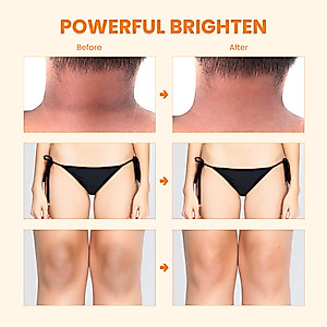 Dark Spot Cream, Brightening Cream, Underarm Cream for Armpit, Skin, Body, Elbows, Knees, Neck, Private Areas