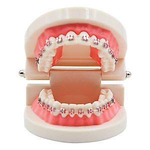 Standard Tooth Teaching Mallocclusion Orthodontic Teeth Model with Brackets Archwire Buccal Tube Tool