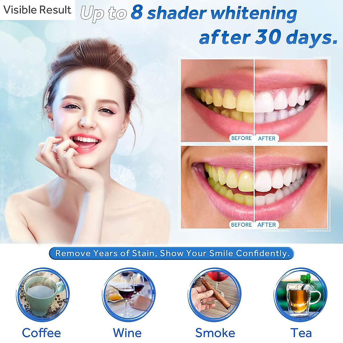 EZGO Dental Mobile Teeth Whitening Lamp Cold Bleaching Teeth Whitening Blue Light Machine LED Teeth Whitener Accelerator Light,Teeth Whitening Gel Refill Pack, 20 Pieces C-Shape Cheek Retractor