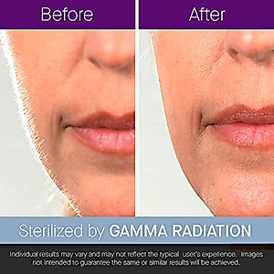 Pack of 100 Disposable Surgical Blades 11, Size 11 Scalpel Blades for Surgical Knife Scalpel, Dermaplaning Tool for Face Professional Dermablade Surgical Blades. 11 Blade, Sterile