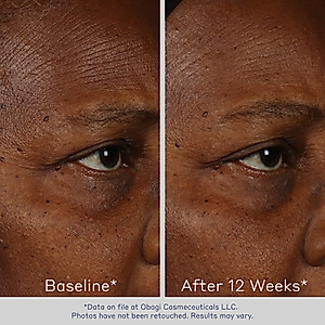 Obagi ELASTIderm Facial Serum – Firming Face Serum with Patented Bi-Mineral Contour Complex Clinically Proven to Target Signs Of Skin Aging – 1 oz