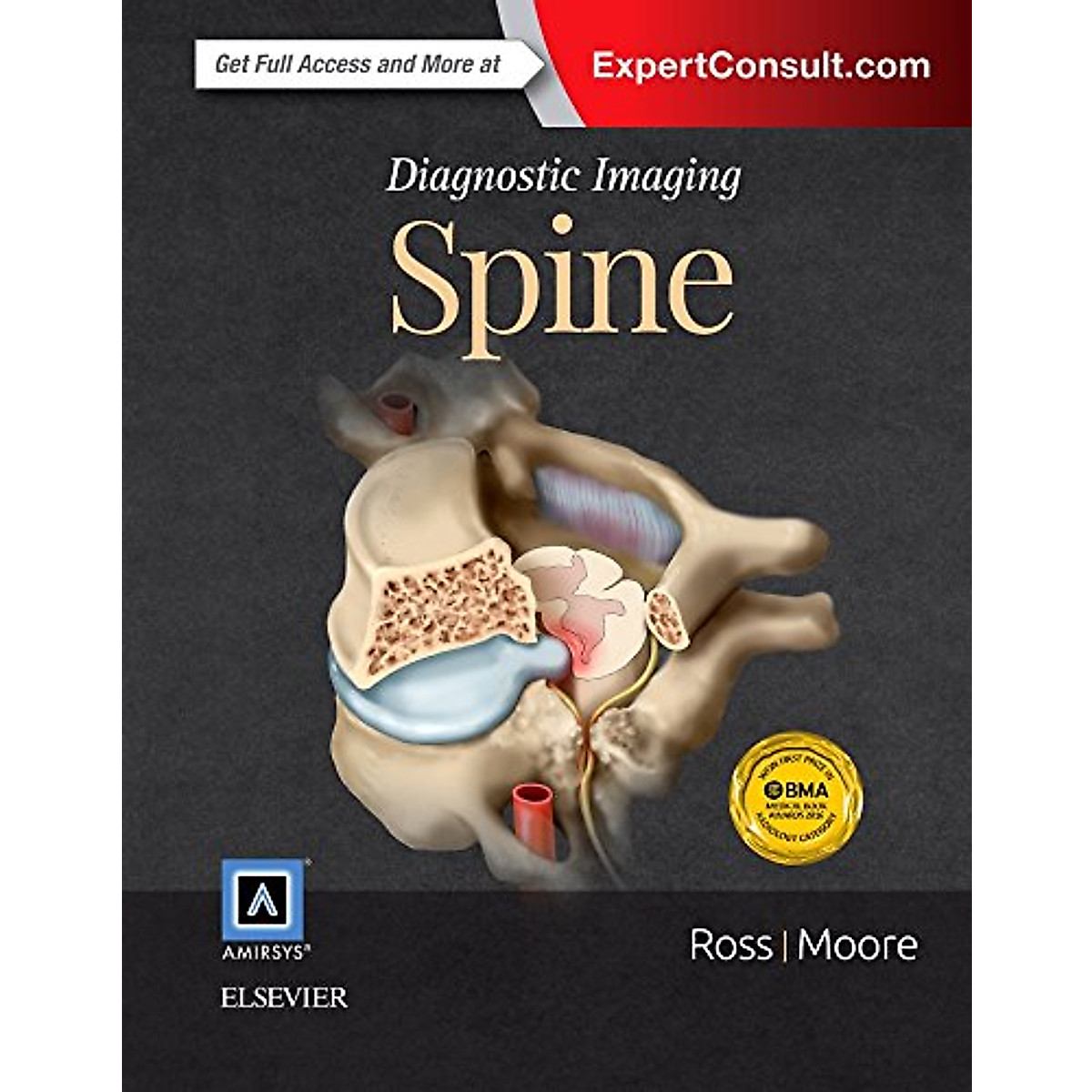Diagnostic Imaging: Spine
