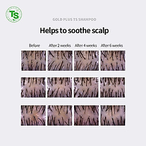 Gold Plus TS Shampoo for Anti-Thinning Biotin Shampoo(16.9 Fl Oz) Luxury Gold Biotin Ingredients | For Damaged, Dry, Thin Hair | Silicone Free