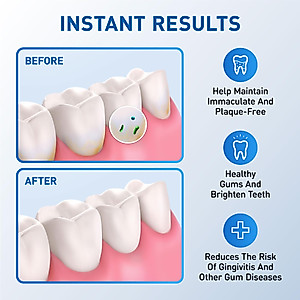 Water Flosser Replacement Tips for Waterpik, Replacement Heads for Waterpik (6 Classic Jet Tips)