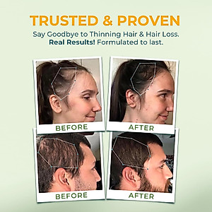 VITAL NUTRITIVE Vital Hair Complex – Biotin & Vitamin B Hair Vitamins for Women & Men – Supports Healthy Hair, Skin & Nails – Hormone-Free, Gluten-Free – Hair Supplement for Women & Men