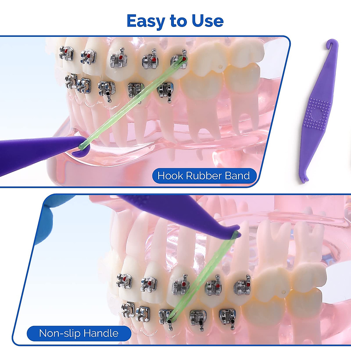 JMU Orthodontic Elastics 1/4 Heavy, 500 Pack Intraoral Elastic Bands Non-Latex Neon Dental Rubber Bands Made in USA
