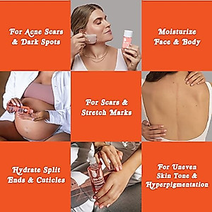 Bio-Oil Skincare Body Oil, Vitamin E Serum for Scars & Stretchmarks, Dermatologist Recommended, All Skin Types, 6.7 oz