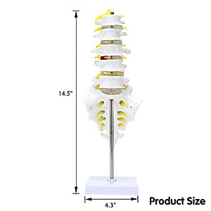 MIIRR Life Size Lumbar Spine Anatomical Model with A Herniated Disc at L4, Lumbar Spine Model with Sacrum and Spinal Nerves