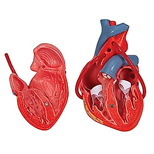 3B Scientific G05 Classic Heart w/ Bypass 2-part - 3B Smart Anatomy