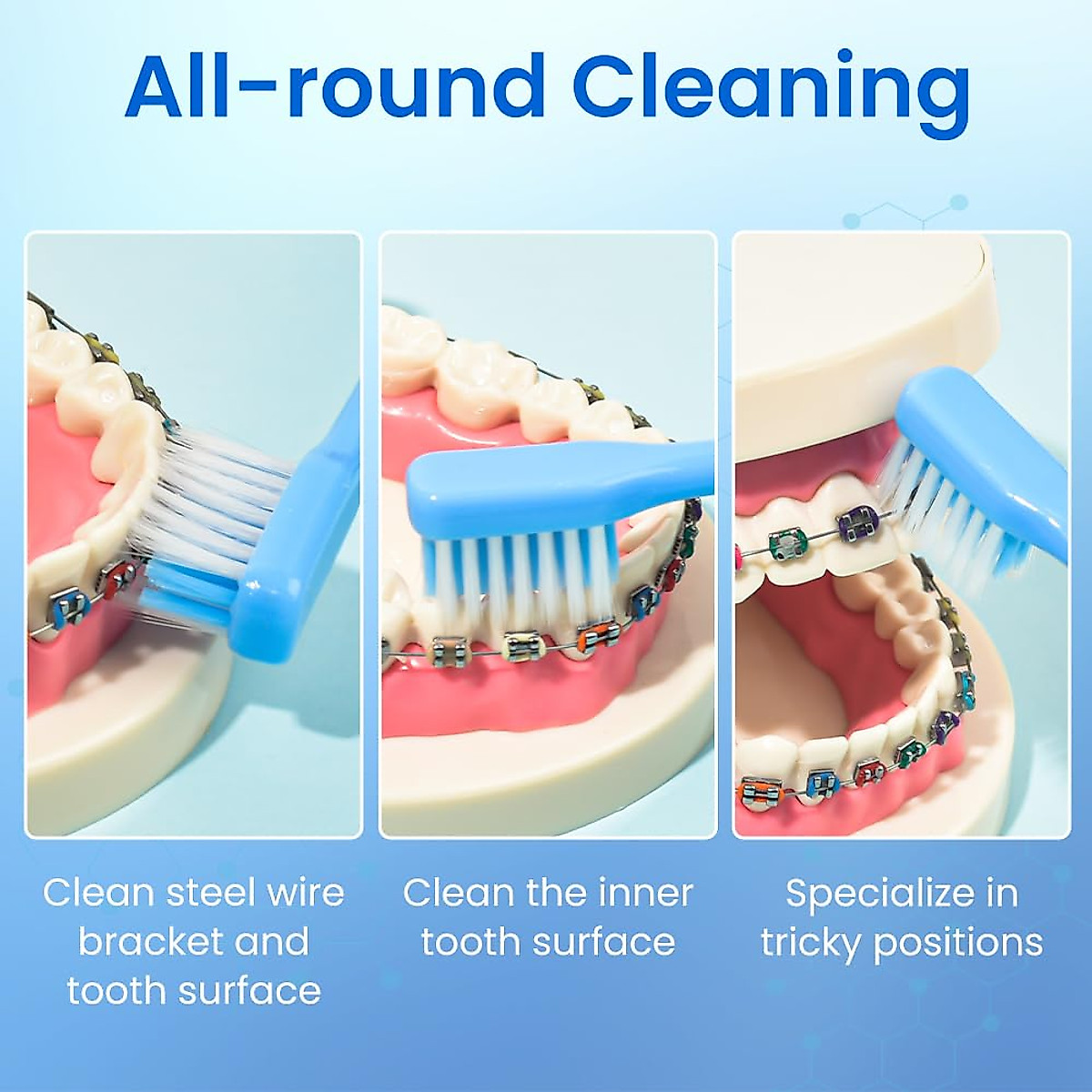 Y-Kelin V-Shaped Orthodontic Toothbrush for Braces Brackets 4 Count (Pack of 1) Soft Bristle with Inter Dental Brush