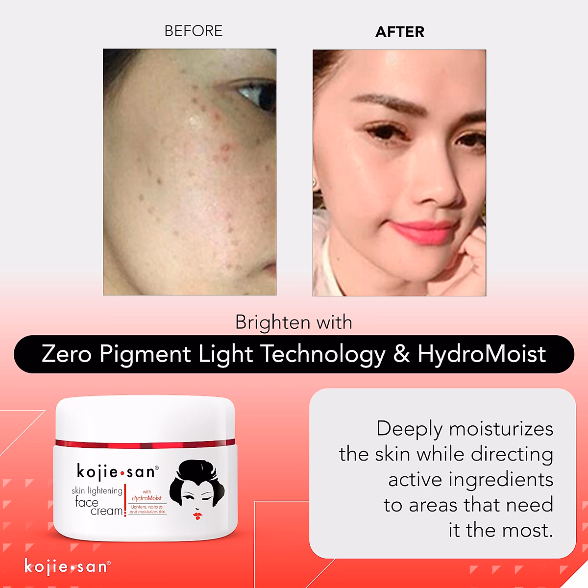 Kojie San Face & Body Complete Brightening Mini Set - 65 Gram x 2 Bars Soap, Body Lotion, Face Cream, and Facial Cleansing Brush