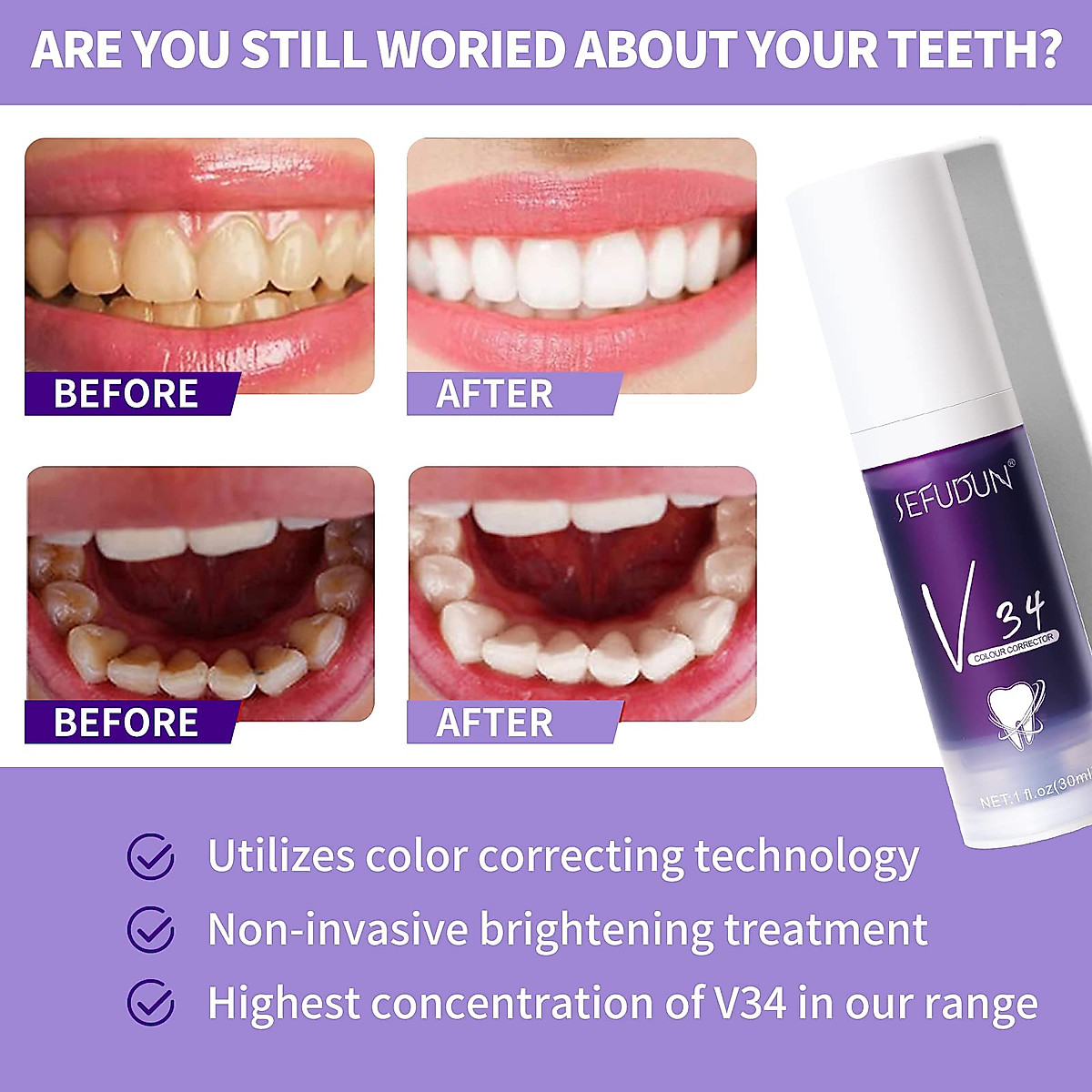 Total Whitening Repair Toothpaste 2 Pack, High Concentration of V34 for Sensitivity Relief and Cavity Protection, Complete Protection and Prevention Teeth Problem, 1 fl.oz (Pack of 2)