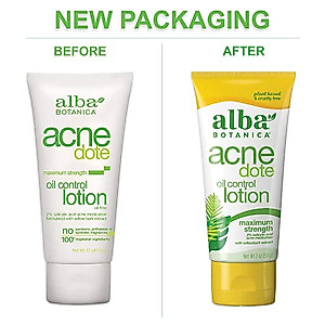 Alba Botanica Acnedote Maximum Strength Oil Control Lotion, 2 Oz