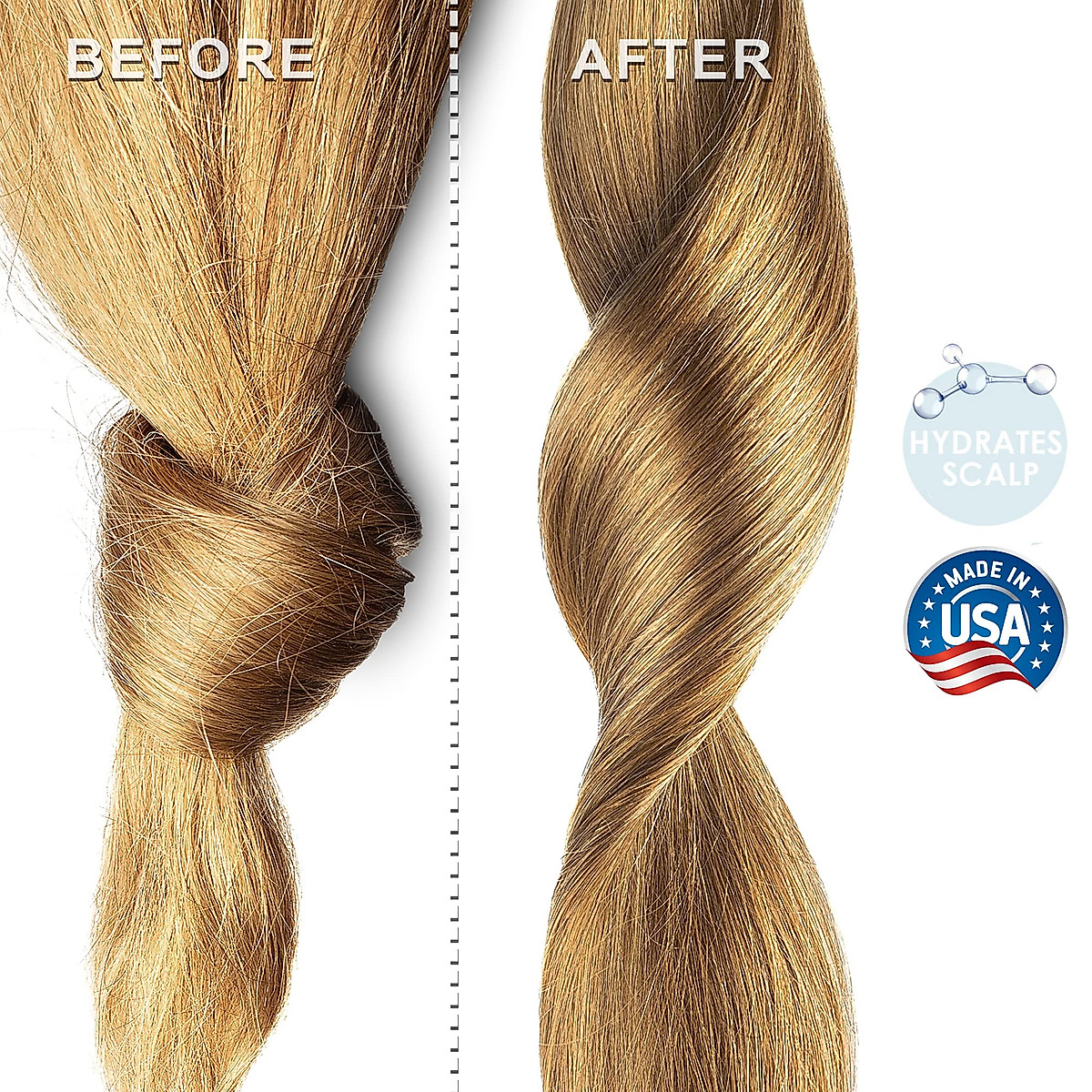 Soapeauty Apricot Kernel Oil Cold Pressed 100% Pure Natural Apricot Oil for Skin, Face, Hair Carrier for Essential Oils, Massage | 32 OZ