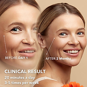 NEWKEY Red Light Therapy Mask for Face Wrinkles, LED Face Mask Light Therapy,7 Colors Photon Red Light Therapy Mask for Face, 20 Minutes Treatment,Adjustable Strap,Plug-in