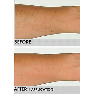 Epilady Drop Rechargeable Wet/Dry Epilator - Hair Removal Epilator, Cordless Wet/Dry Hair Remover for Women, Epilator for Shower